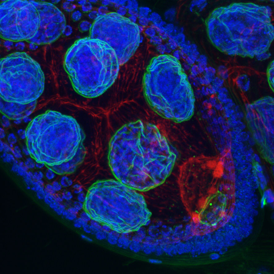 Microscopy Adaptive Optics Day – MIVOA Project – France-BioImaging