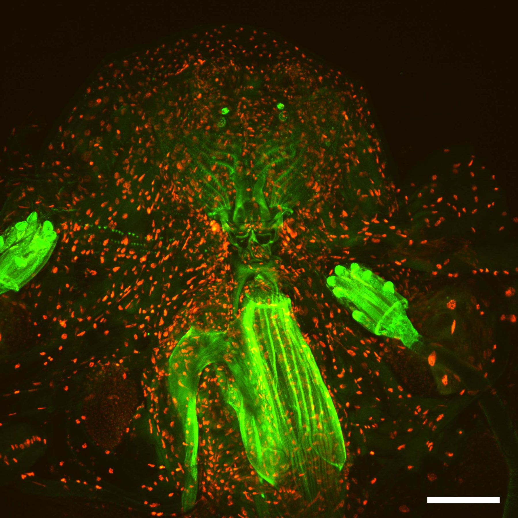 Electron Microscopy course – France-BioImaging