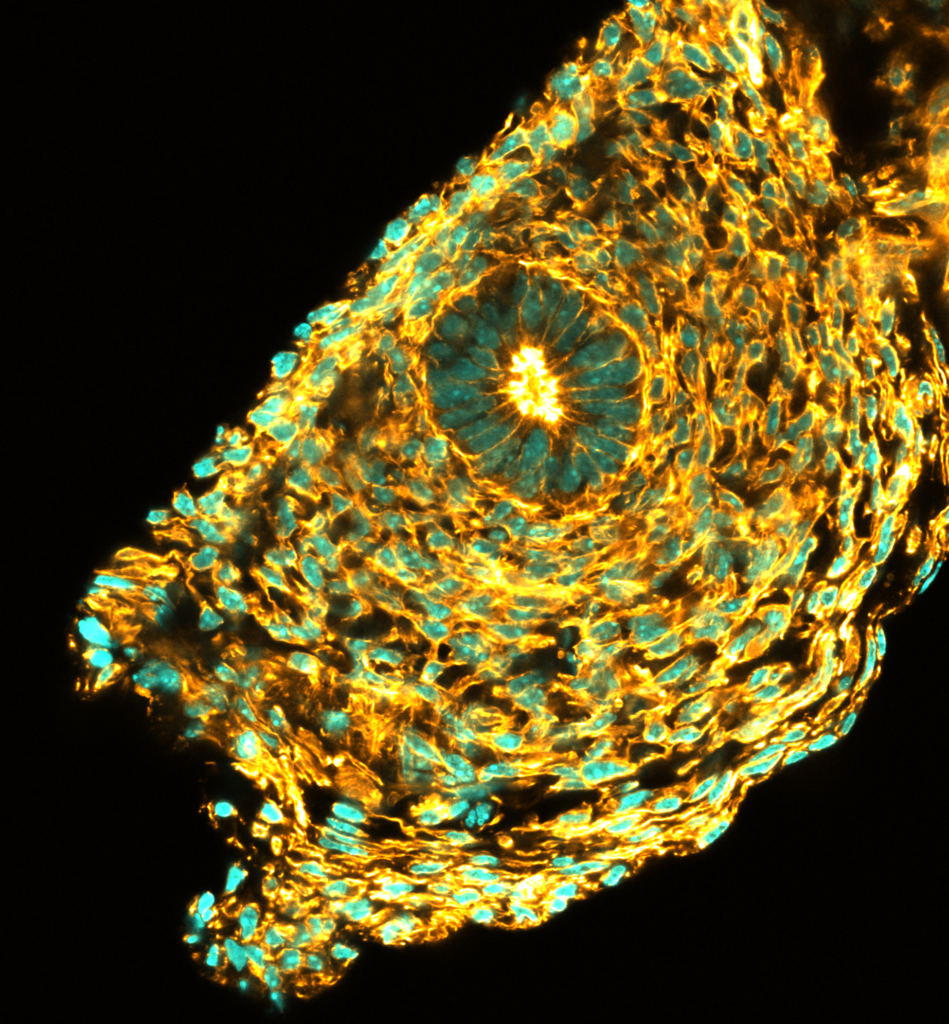 France BioImaging at Focus on Microscopy 2017 – France-BioImaging