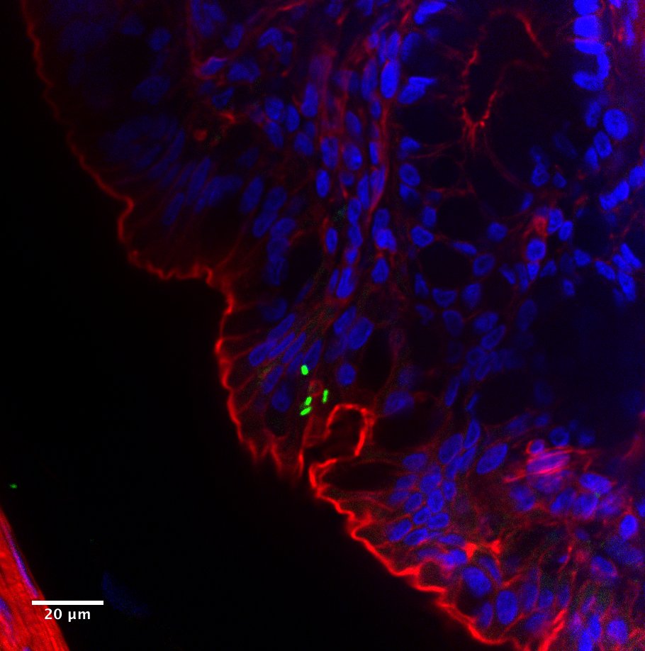 Fluorescence Microscopy Workshop II on cutting edge technologies ...
