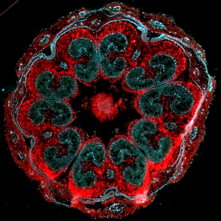 Workshop on High-Resolution Light Microscopy – 2nd Edition - France ...