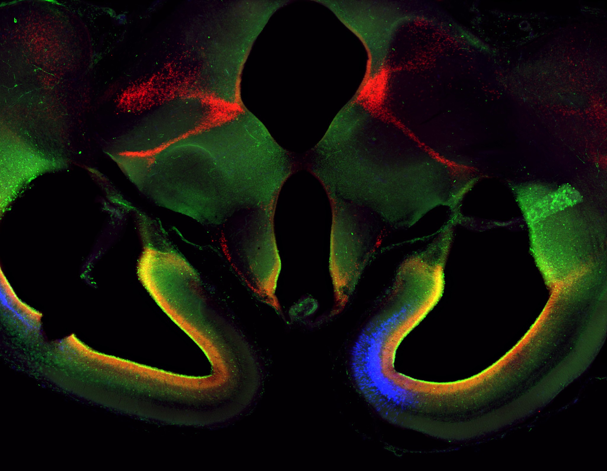 L’éléphant tricéphale – France-BioImaging