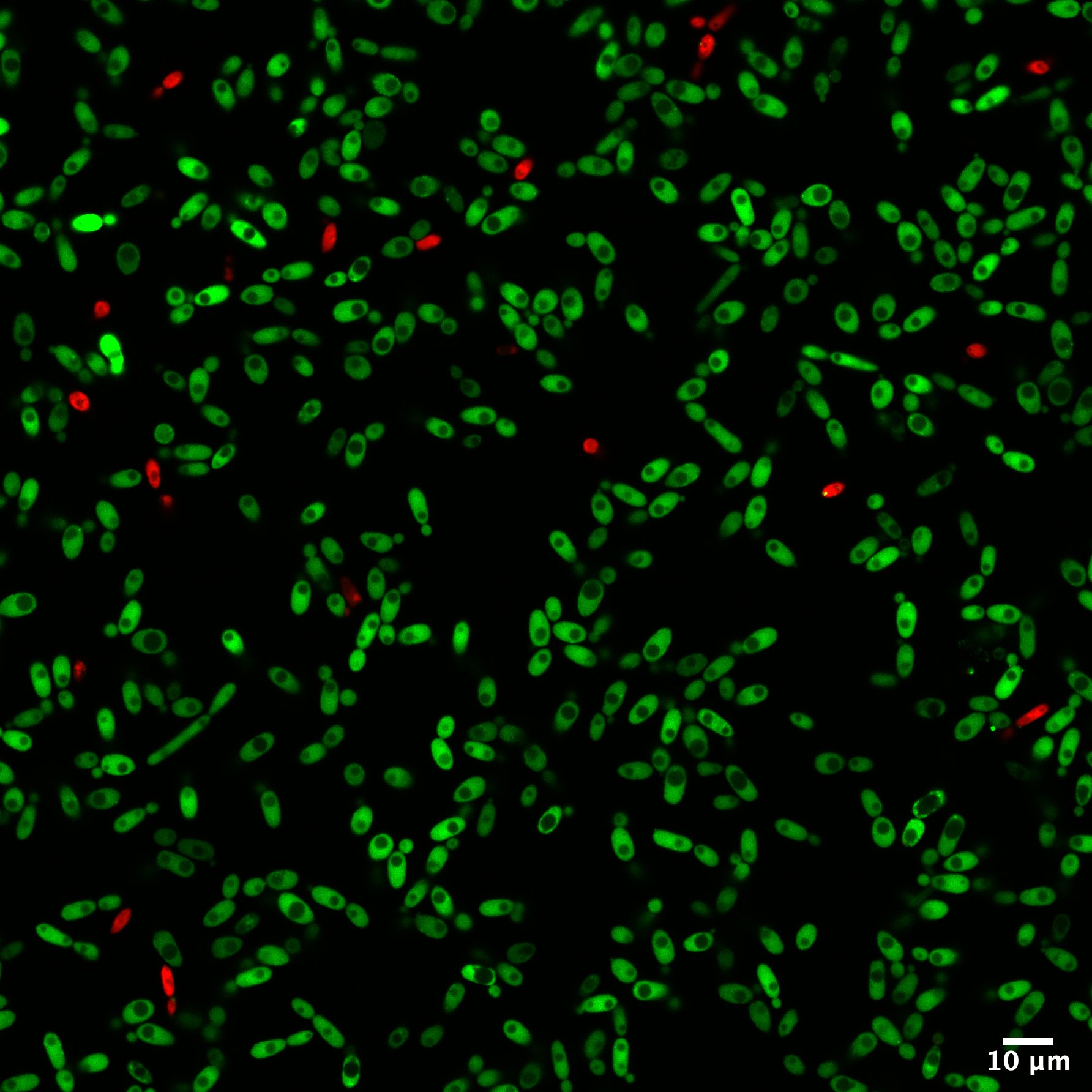 A yeast responsible for horse sweat in wine: the Brettanomyces ...