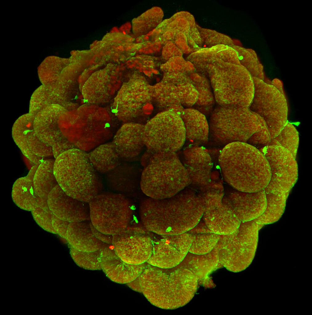 Toulouse – France-BioImaging