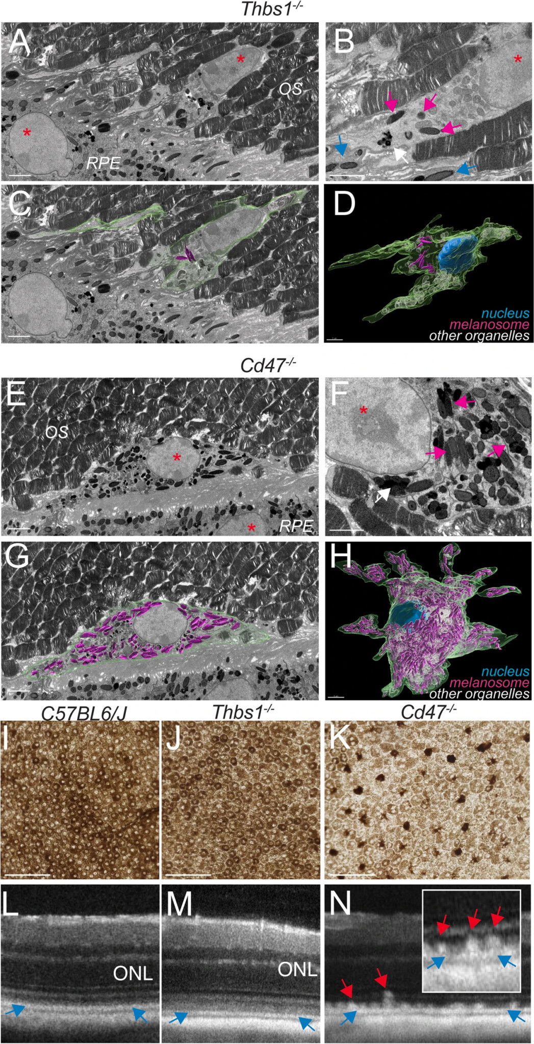 Using SBF-SEM to better understand an eye degeneration disease: the AMD ...