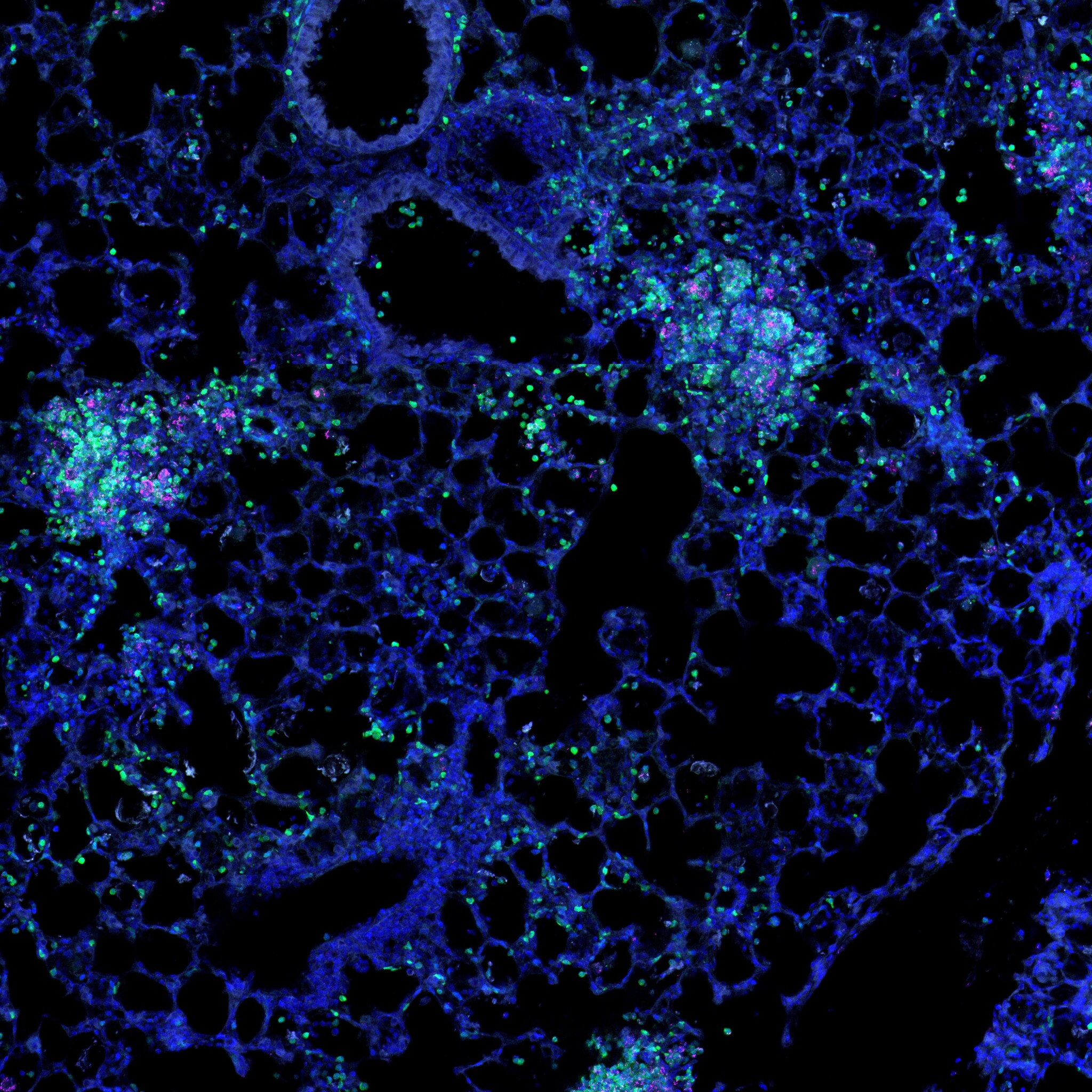 Join the 2nd webinar of the “Preclinical Microscopy” Working Group ...