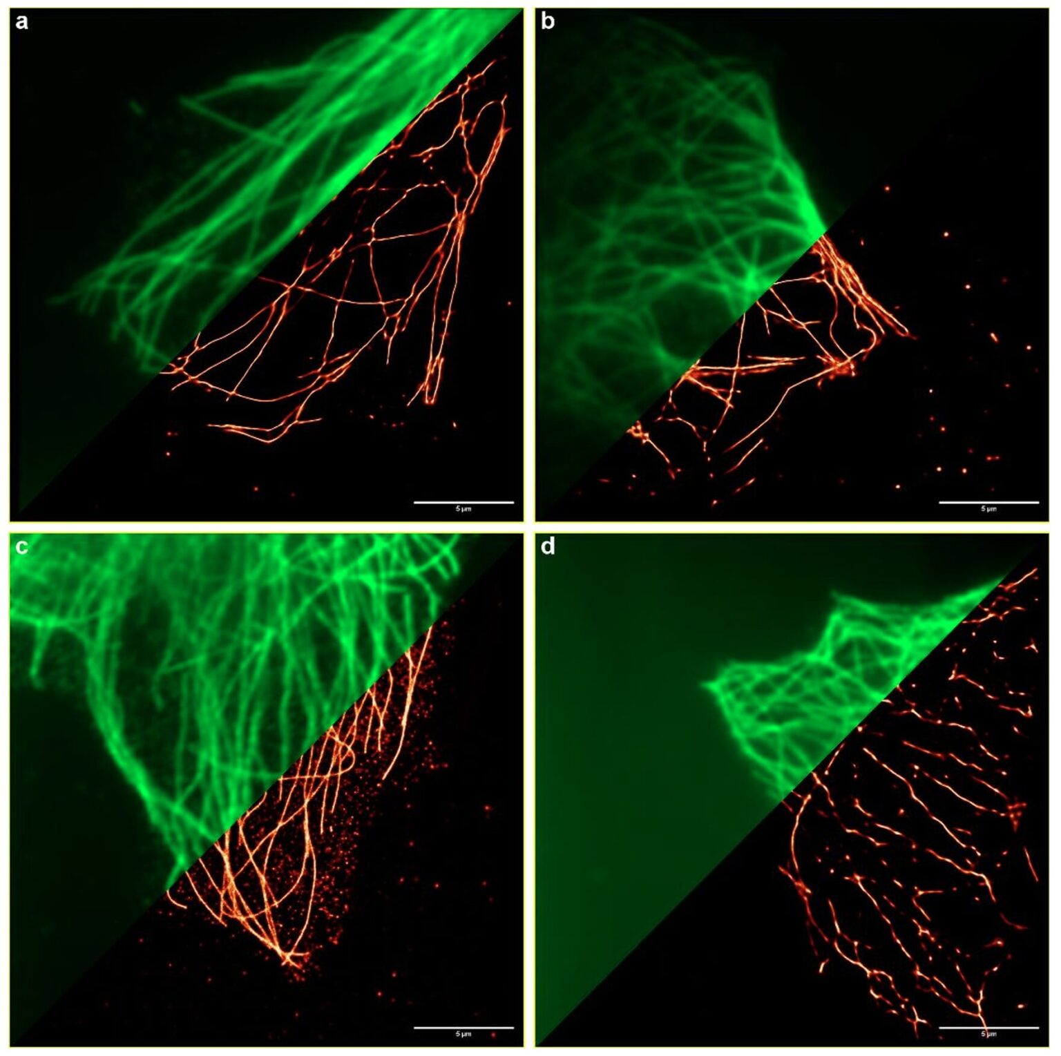 Improving DNA-PAINT speed with a fluorogenic DNA probe – France-BioImaging